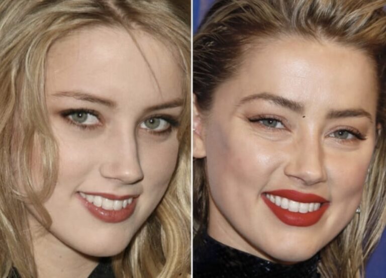 Familiar Smiles: Celebrities Who Got Their Teeth Done (July 2025 ...