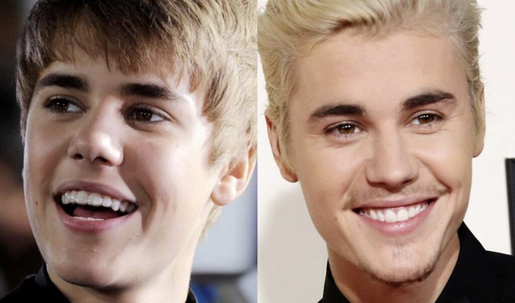 Familiar Smiles: Celebrities Who Got Their Teeth Done (July 2025 ...