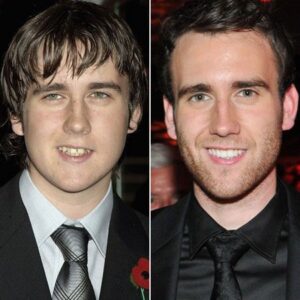 Familiar Smiles: Celebrities Who Got Their Teeth Done (July 2025 ...