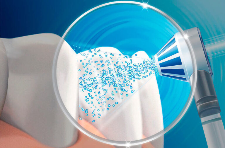 Dental Water Jet for Oral Hygiene: The Ultimate Guide